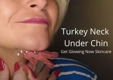 Turkey Neck - Under Chin | Get Glowing Now Skincare - DIY55