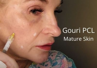 Gouri PCL - Treating Mature Skin - DIY55