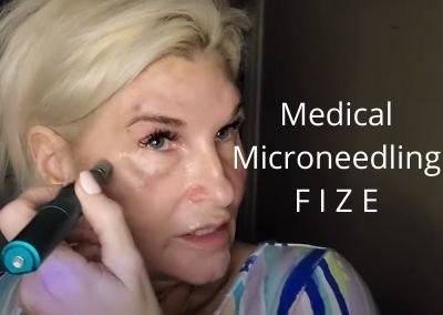 Medical Microneedle with Fize - Glass Skin - DIY55