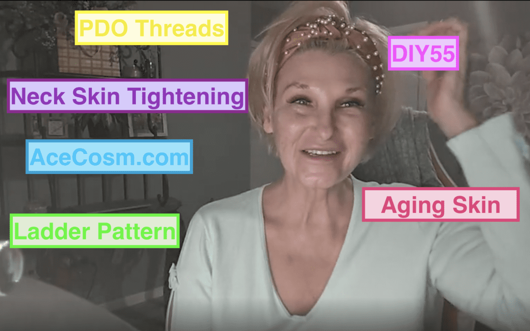 Neck Skin Tightening with Ladder Pattern and PDO Threads - DIY55
