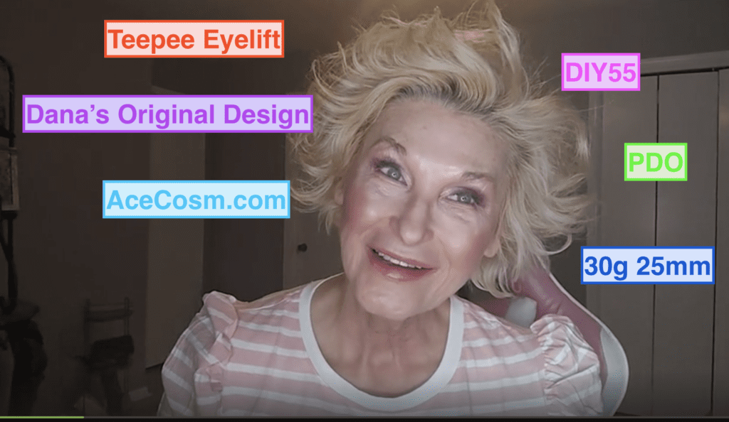 Teepee Eye Lift with PDO Threads - DIY55