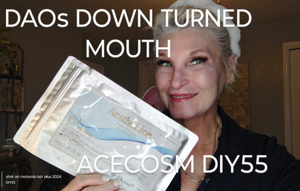 DAO and Neck Lift with PDO Threads - DIY55