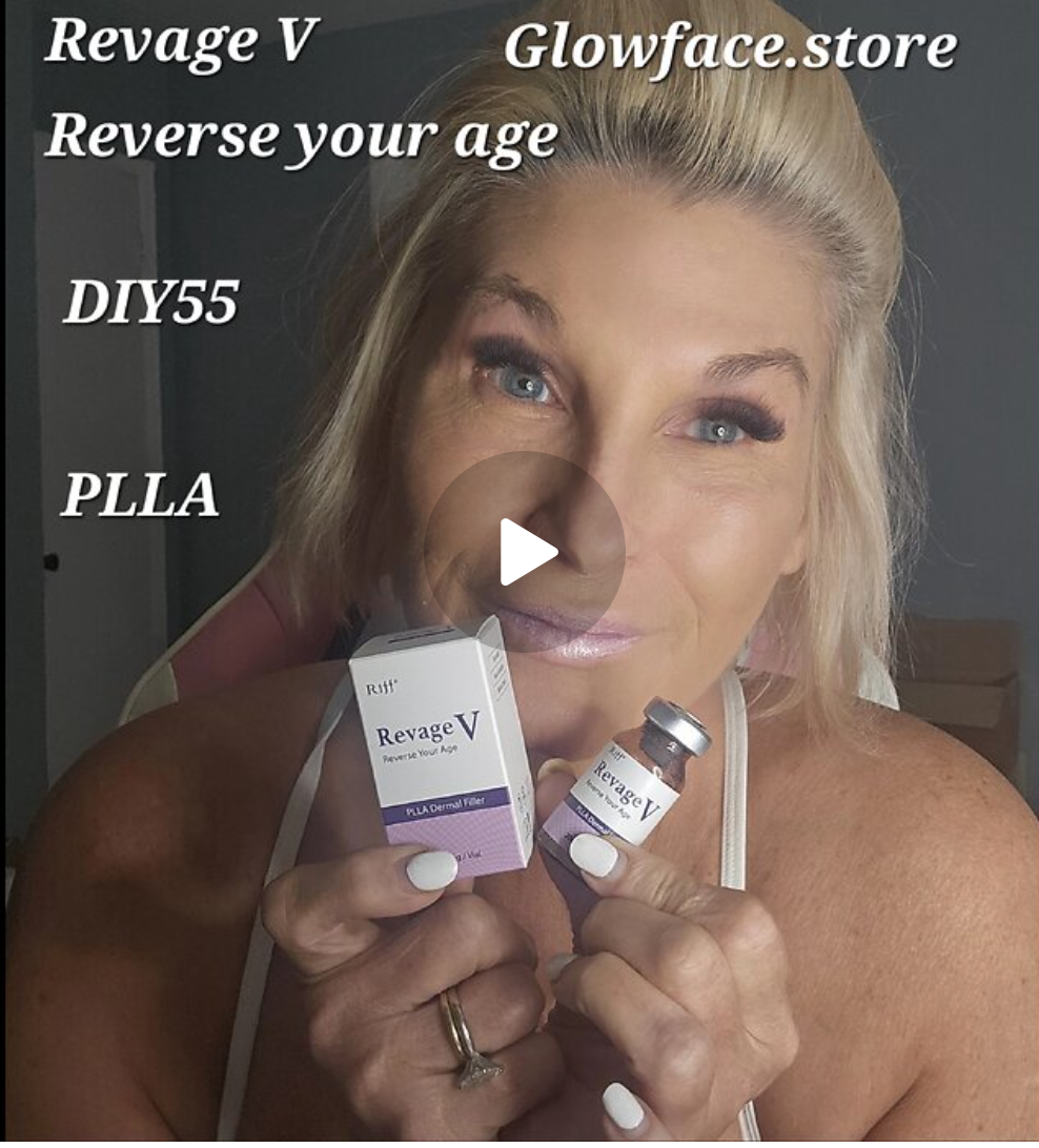 Revage V: Using Filler for Cheeks - DIY55