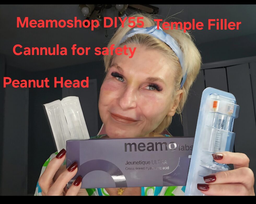 Temple Filler with a Cannula - DIY55